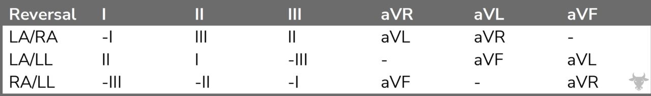 Limb Lead Reversal | ECG Stampede