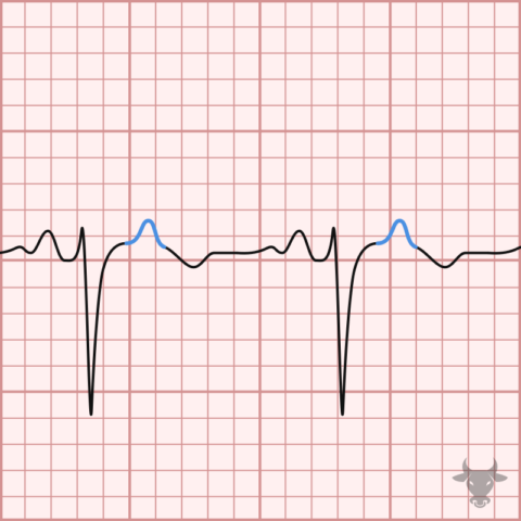 Lewis Lead | ECG Stampede
